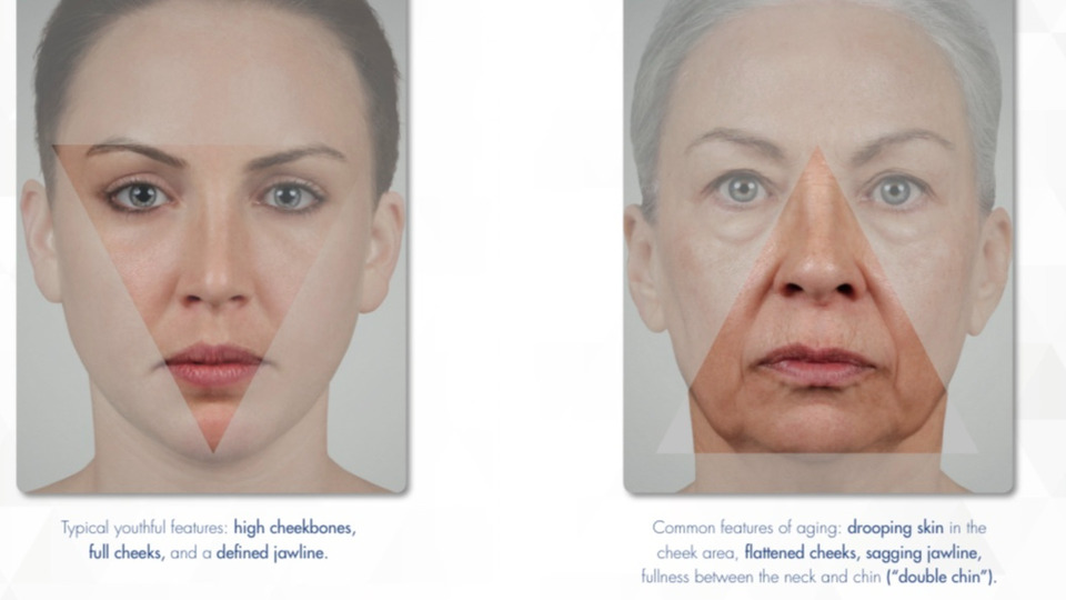 Cheek, Sinus, & Mouth Area: Release Tension, Tone, Tighten, & Lift